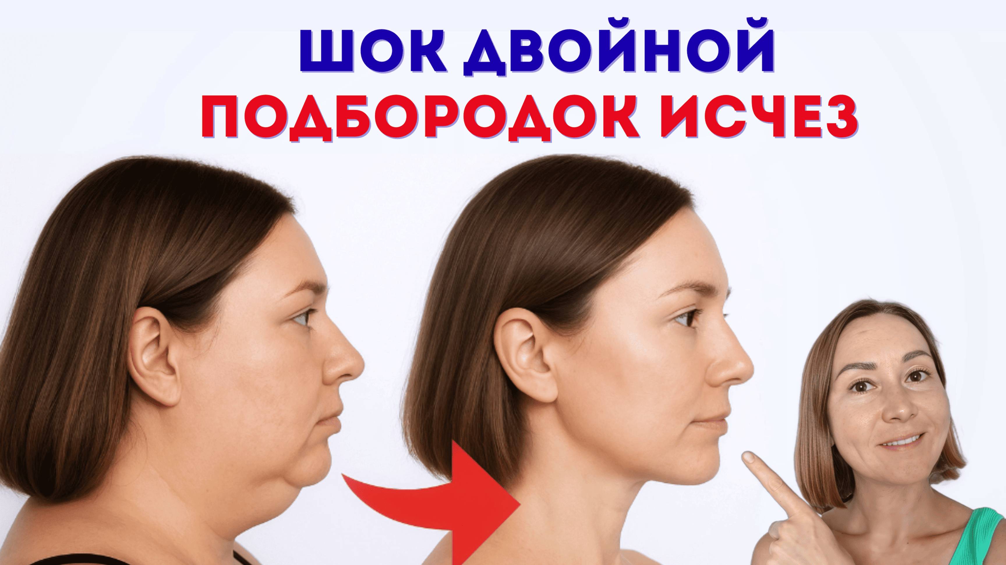 ЛИЦО ПОДТЯНЕТСЯ: устраняем СКРЫТУЮ ПРИЧИНУ второго подбородка