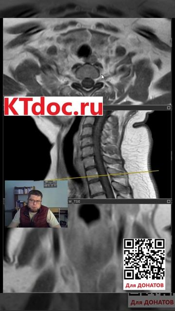 Щитовидная железа на МРТ #mentor #ct #кт #наставник #мрт #mri #mentor #наставник  #ktdoc #ктдок