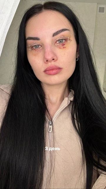 💫 Как избавиться от уставшего взгляда?