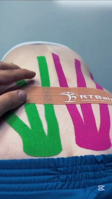 тейпирование при отеке и боли в пояснице #RTBalance #АВАР #Лауста