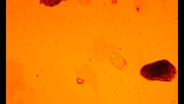 Ведро микробов