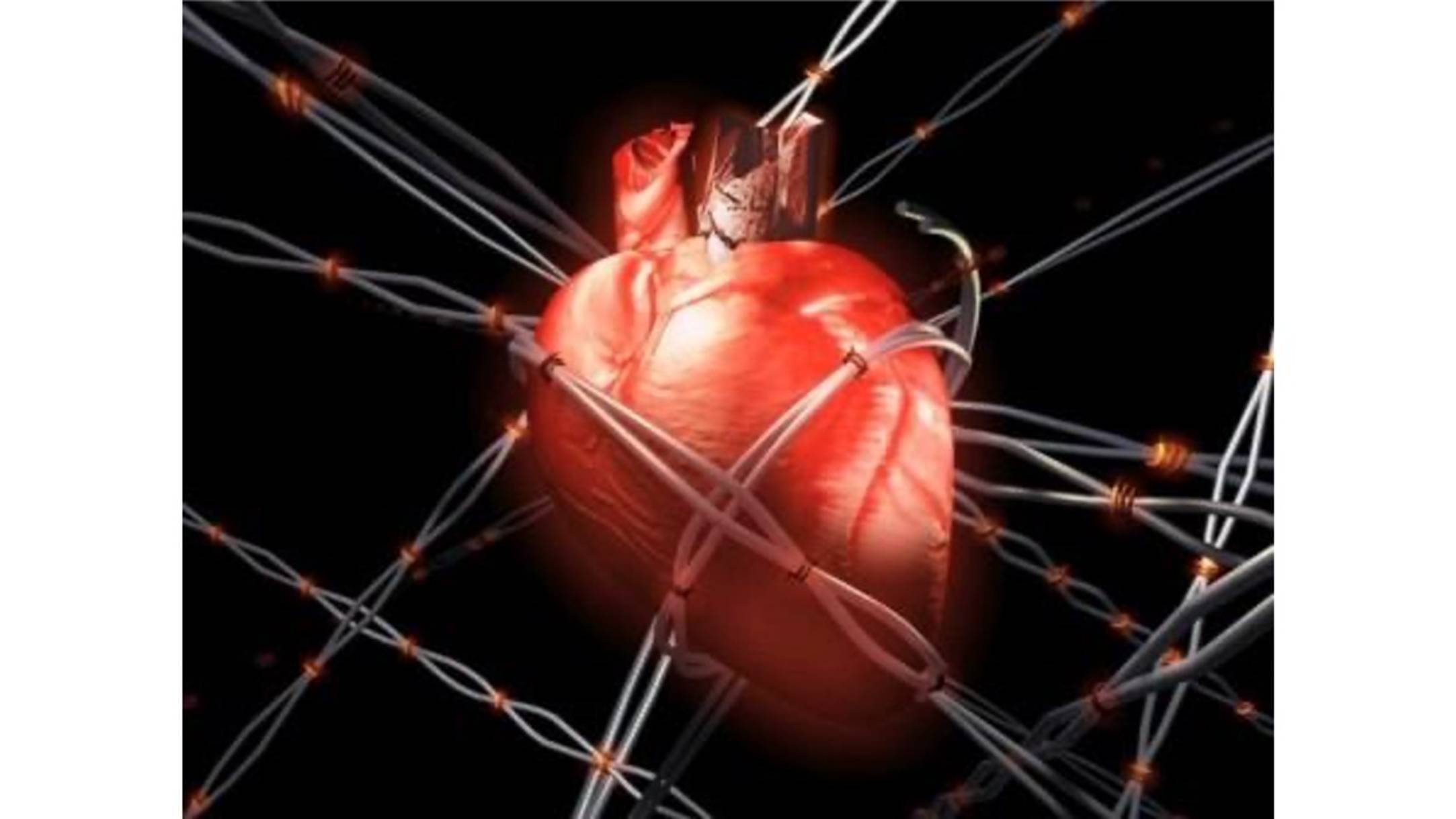 Фасциальное расслабление в профилактике сердечно-сосудистых заболеваний.