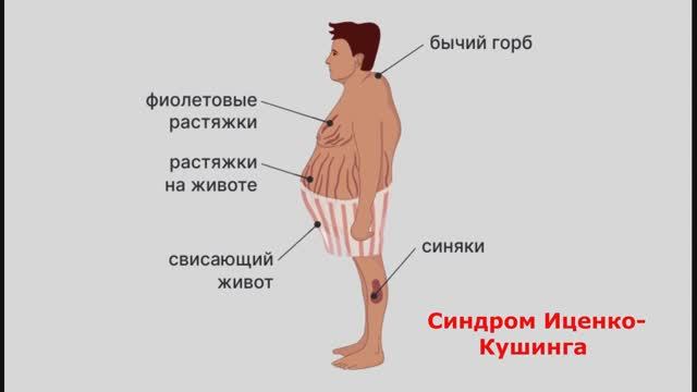 Расследование. Откуда у них такой живот? Что в нём? Не уж-то виноват Кортизол?