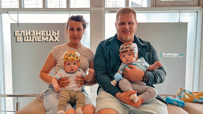Близнецы с деформацией головы