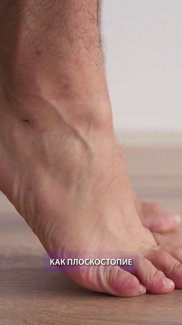 Можно ли ходить в открытой обуви?