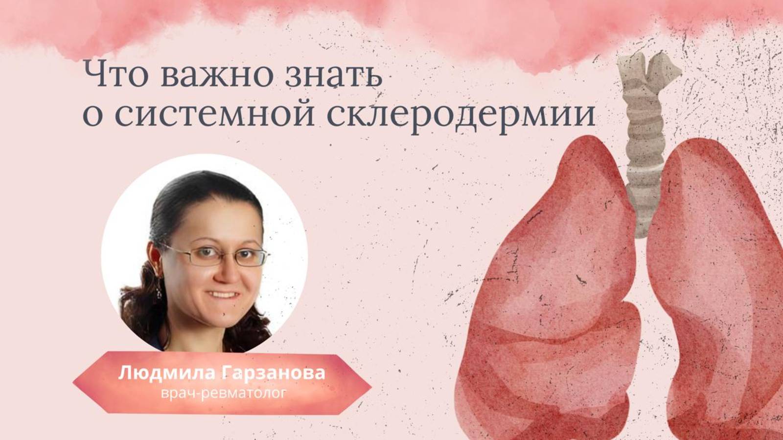 Системная склеродермия: симптомы, диагностика, лечение