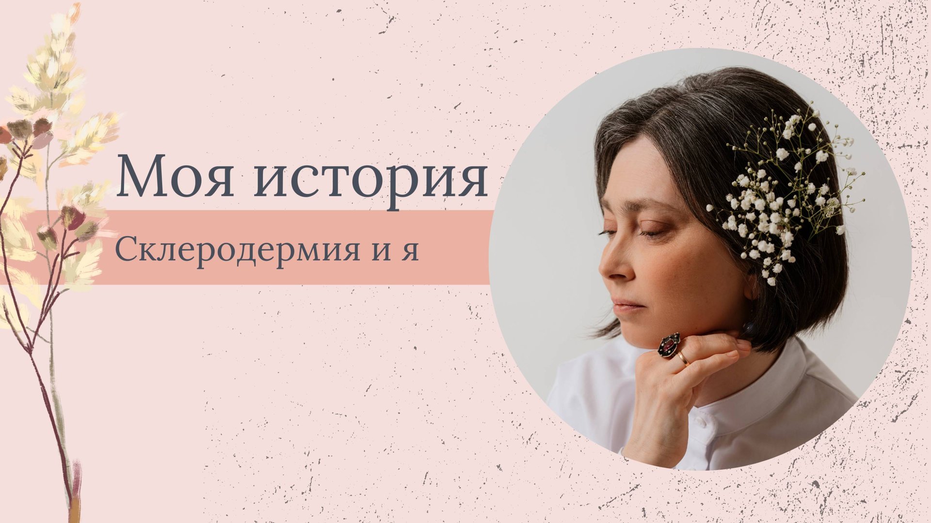 Моя история: склеродермия и я