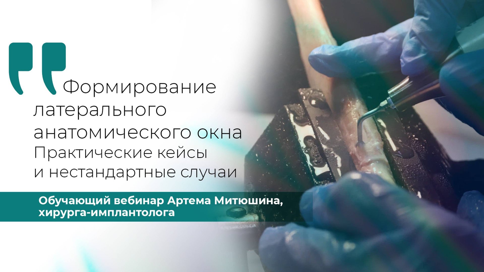 Формирование латерального анатомического окна