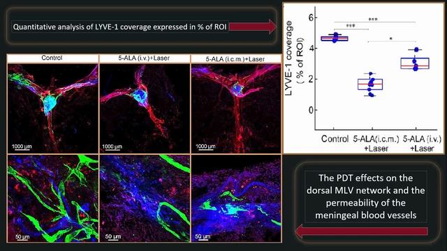 Photodynamic effects on meningeal lymphatic vessels and brain drainage