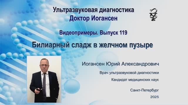 УЗИ. Доктор Иогансен. Видеопримеры. Выпуск 119. Билиарный сладж в желчном пузыре.