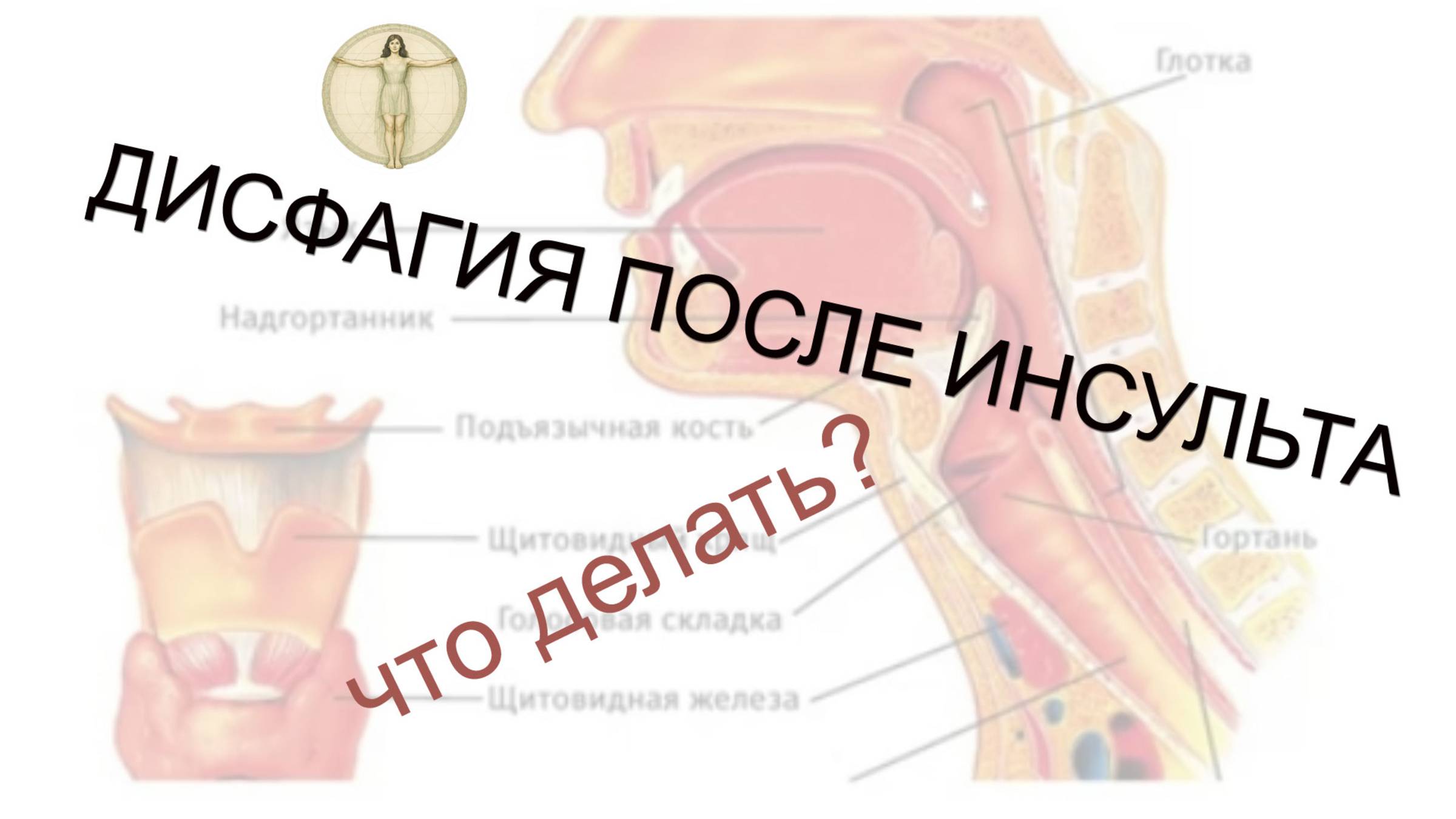 Дисфагия и голосовые связки