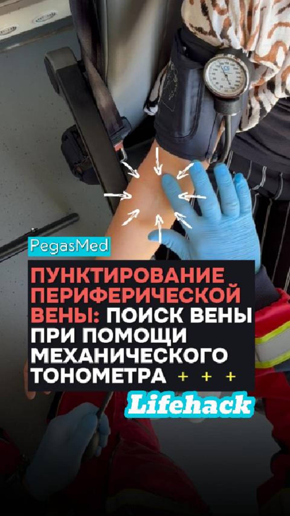 💡ЛАЙФХАК поиск вены при помощи механического тонометра
