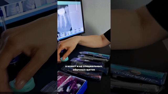 Как ухаживать за имплантатами?