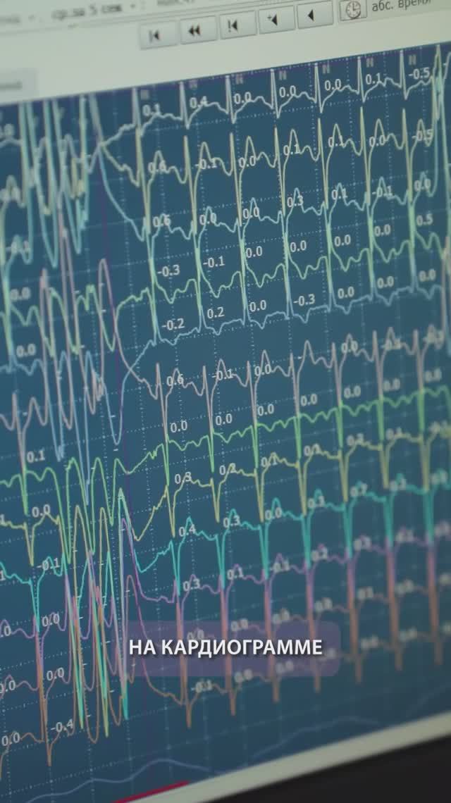 Холтеровское мониторирование сердечного ритма