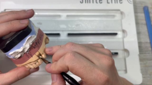 Нанесение керамической массы на металлический каркас