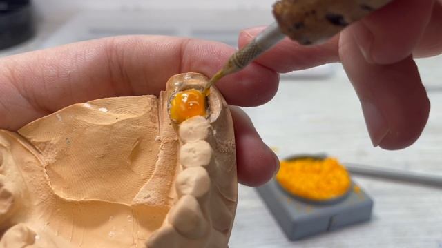 Изготовление культевой вкладки из металла