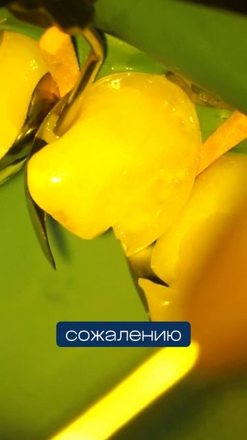 Стоит ли лечить зубы под наркозом? Честный отзыв #ОбщийНаркозУСтоматолога #СтоматологияБезСтраха