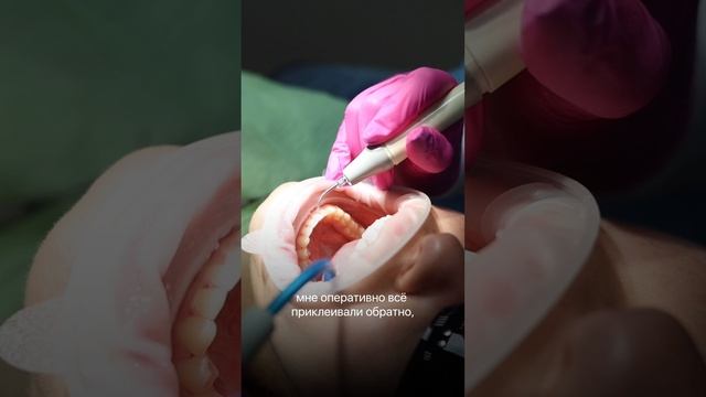 Отзыв Антика .Лечение на брекетах. Снятие брекетов  . Вероника ШолоховаАнтика