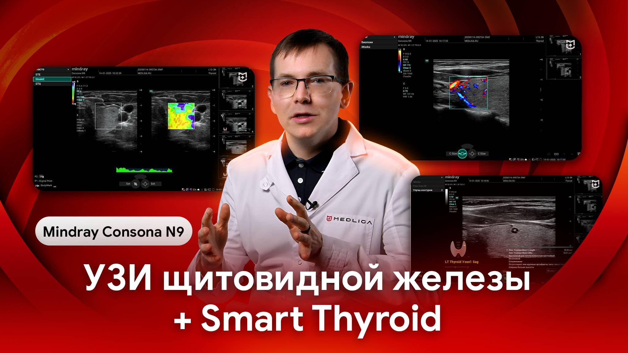 УЗИ щитовидной железы и функция Smart Thyroid на Mindray Consona N9