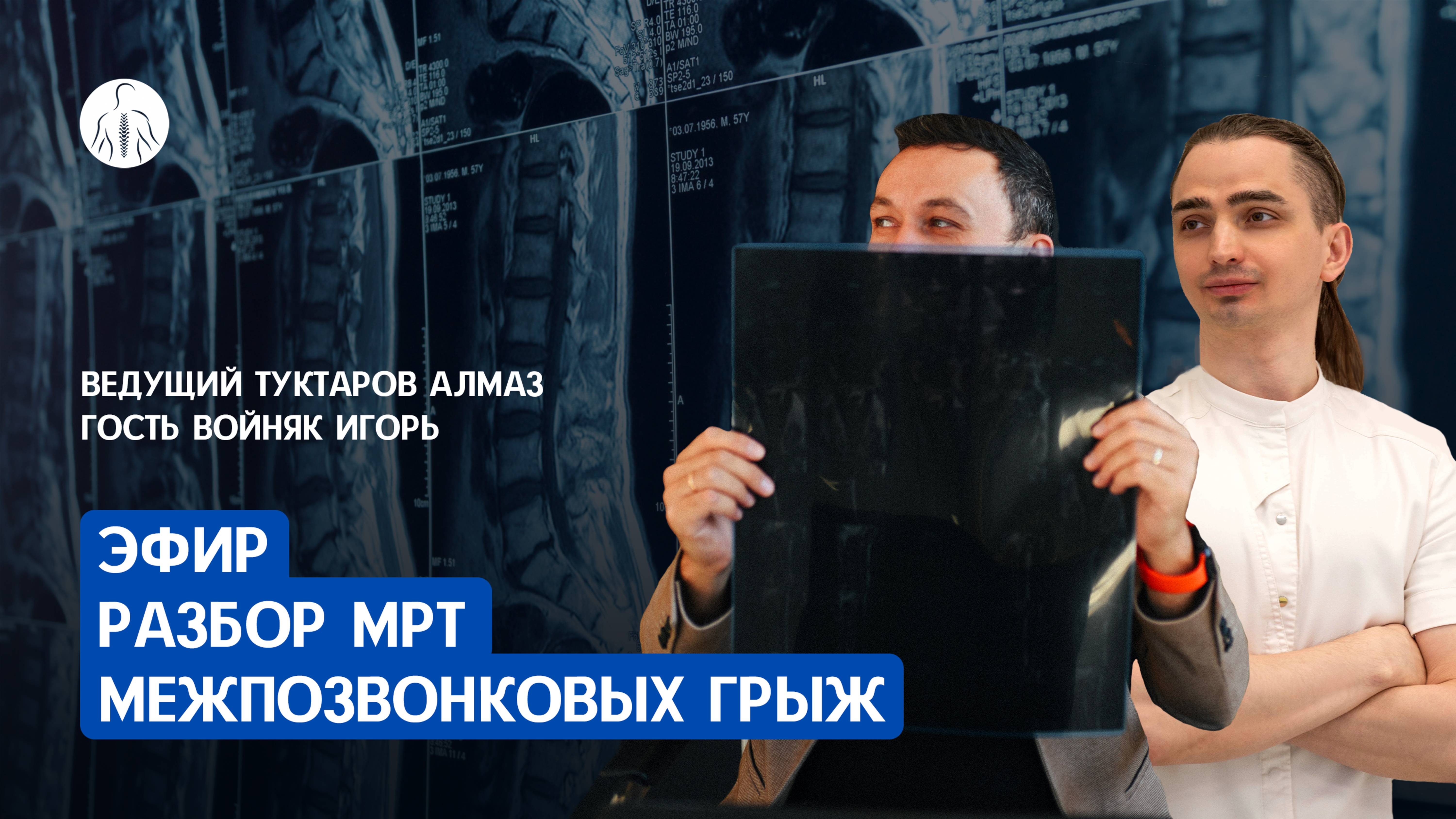 Эфир "Разбор МРТ межпозвонковых грыж"