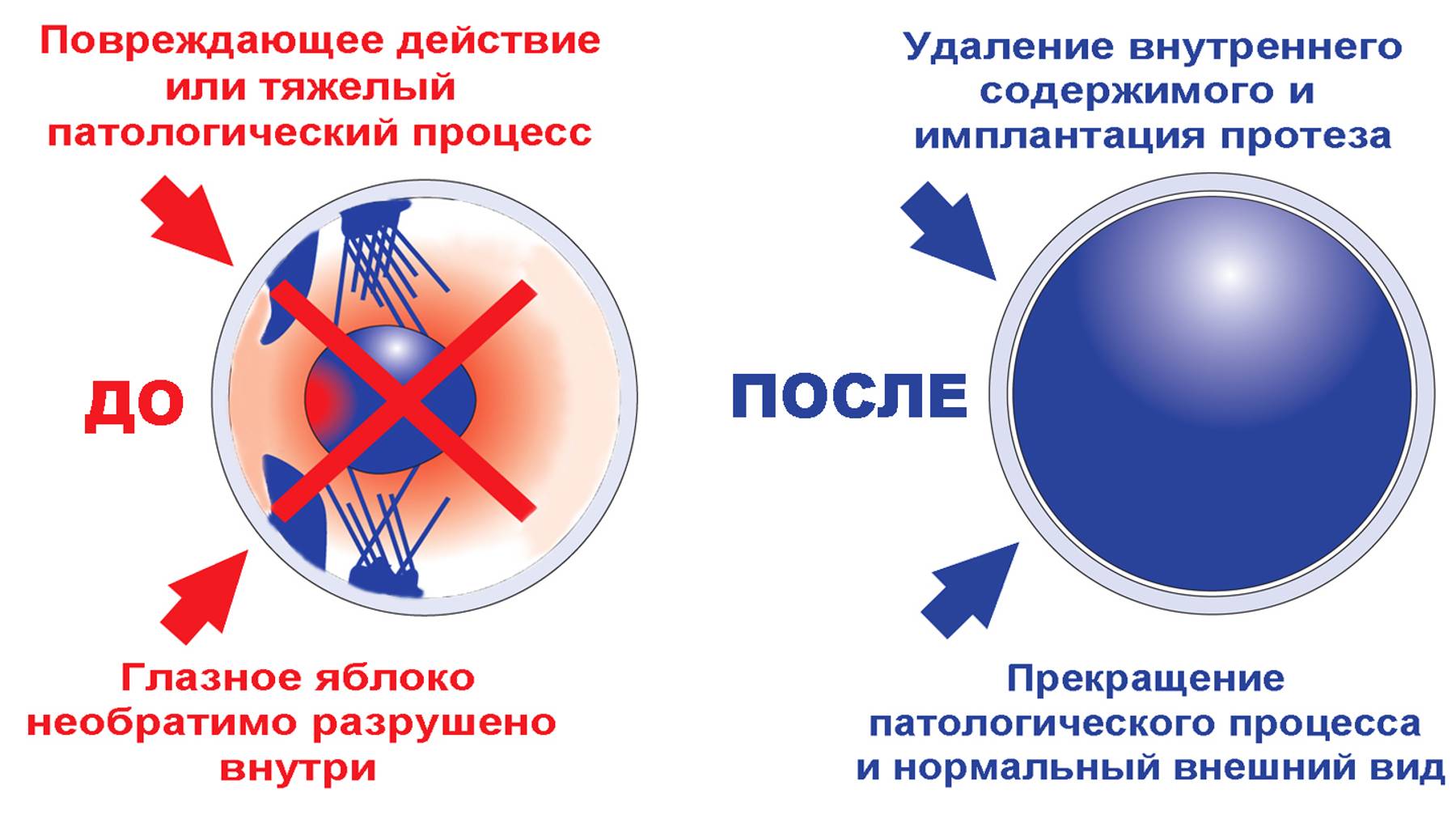 Другая офтальмология. Выпуск 6. Интраокулярное протезирование у животных