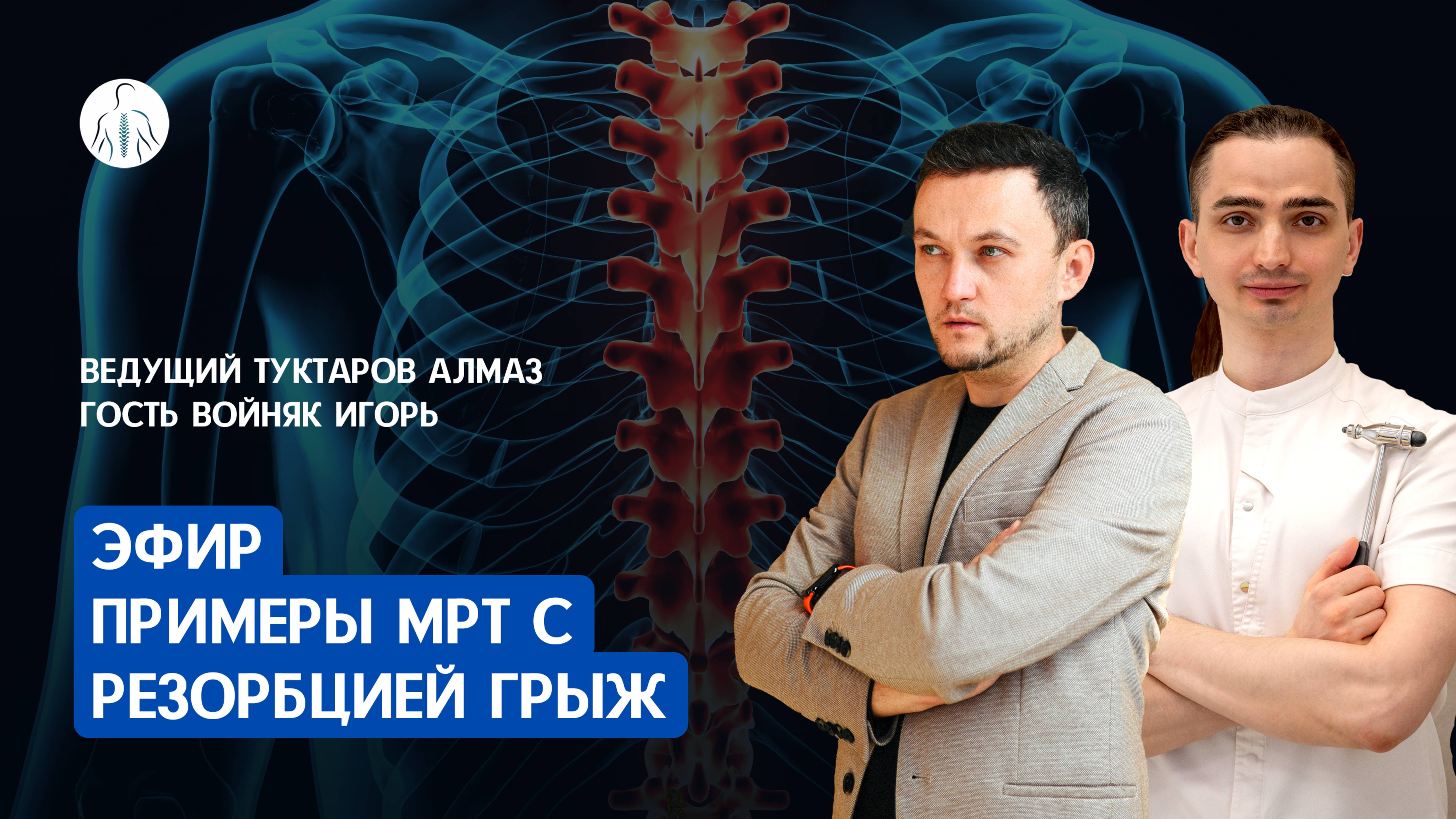 Эфир "Примеры МРТ с резорбцией межпозвонковых грыж"