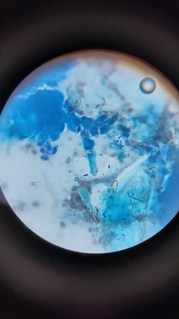 Цитологические исследования / Malassezia / Цитологические исследования домашних животных