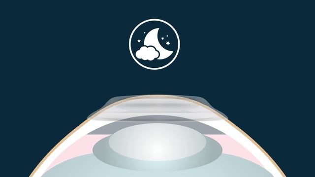 Как работают Moonlens?