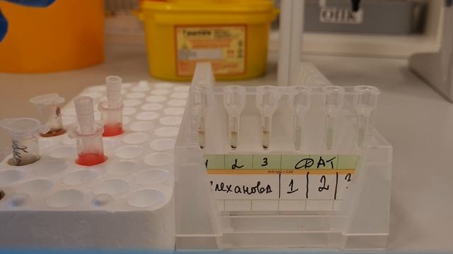 016. Прямая проба Кумбса. DAT. Практика. 07.03.2022 г.