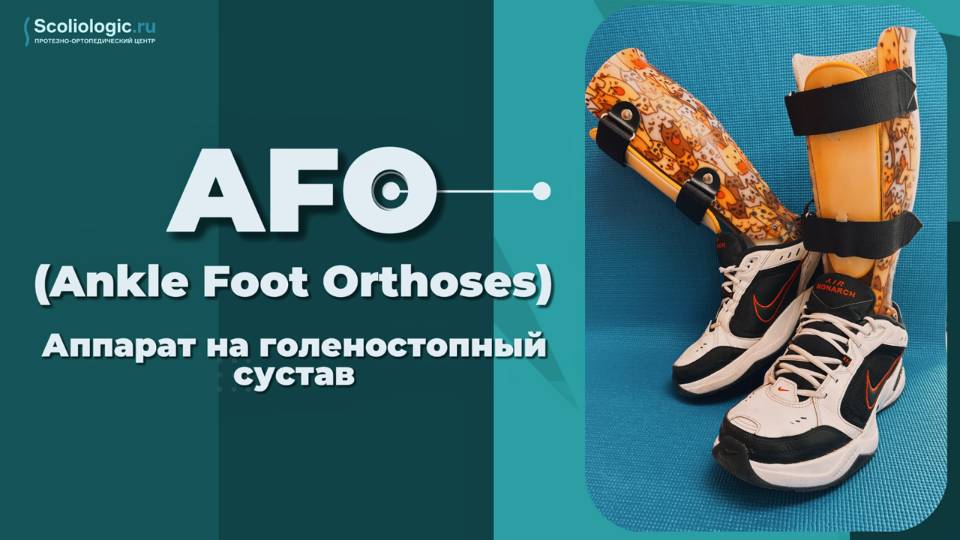 Разбираем ортез по деталям!