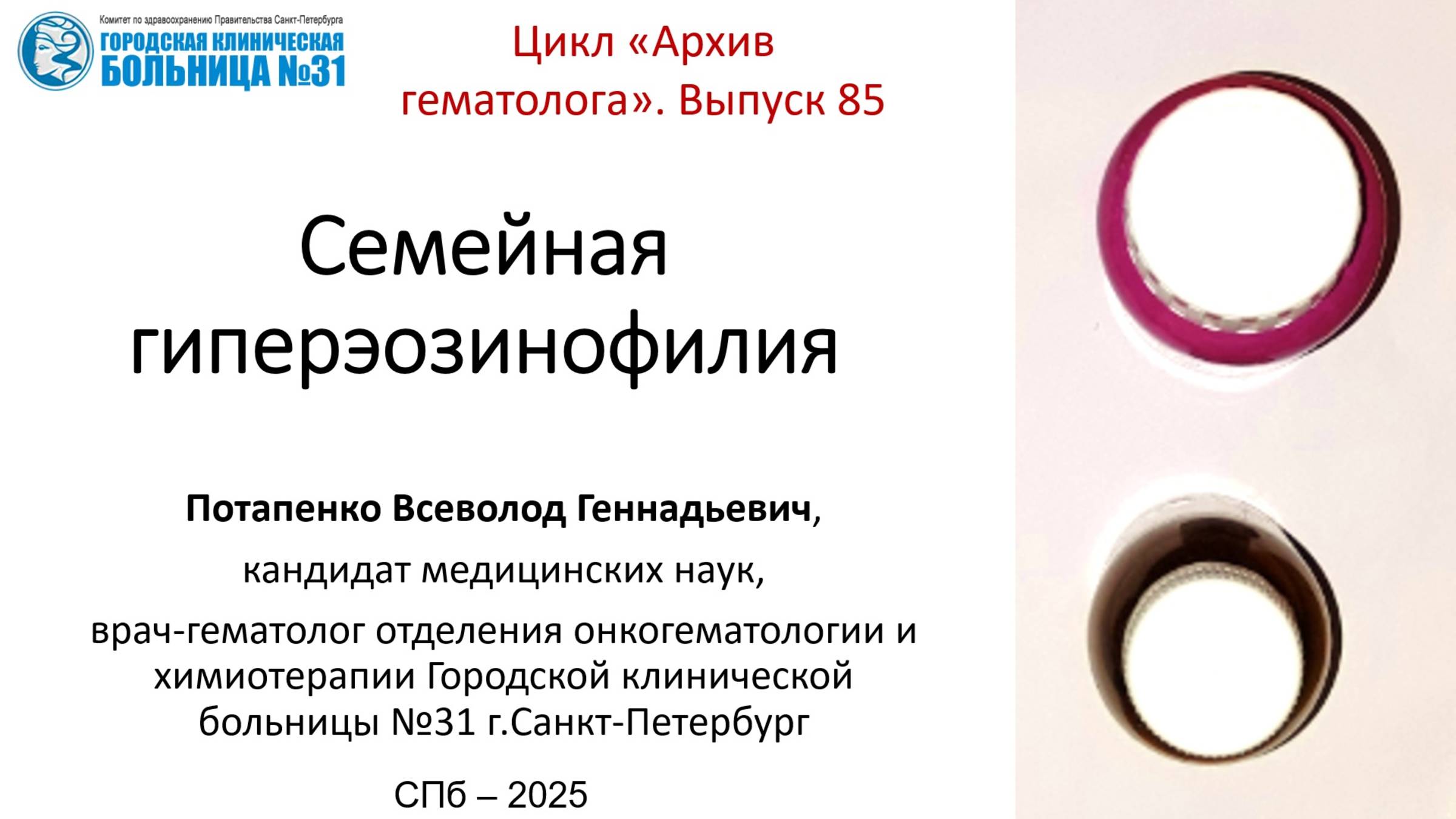 Архив 85. Семейная эозинофилия