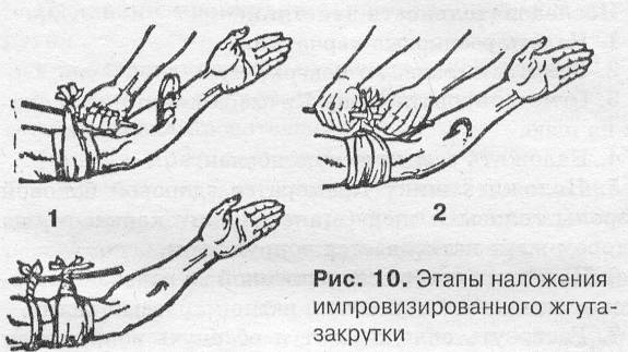 Закрутка - прабабушка турникета