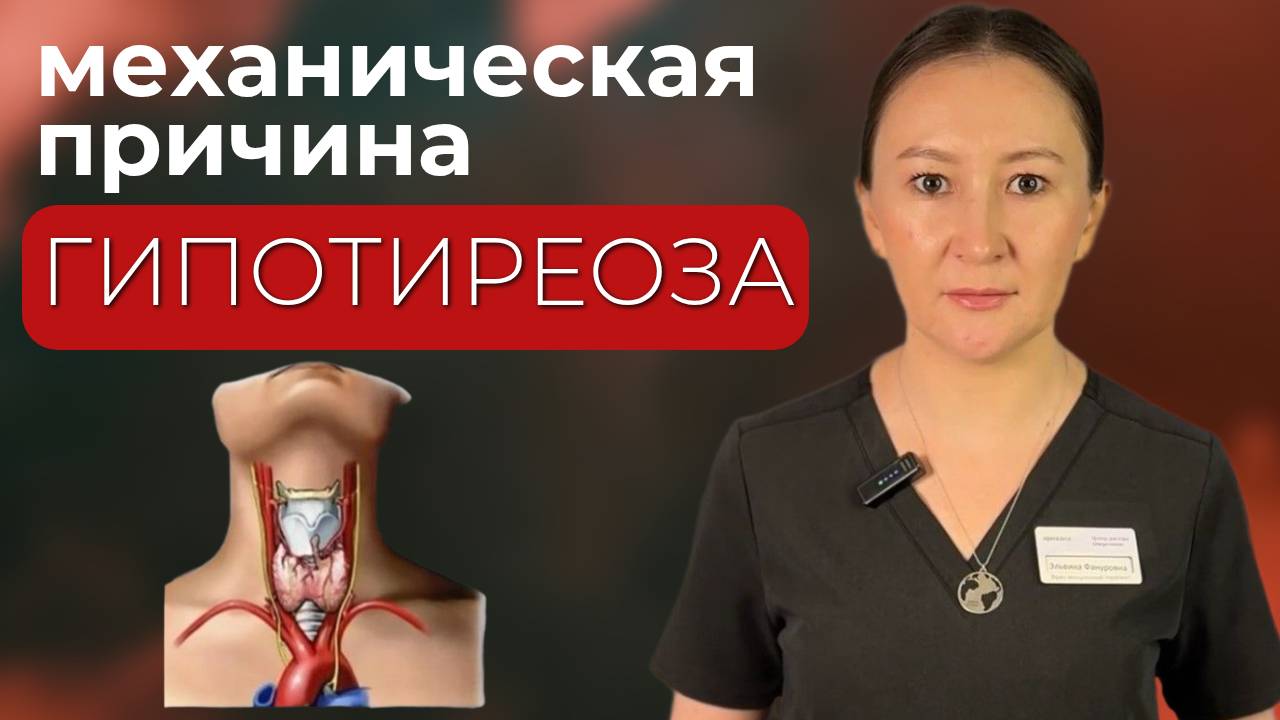 ГИПОТИРЕОЗ: механическая причина появления