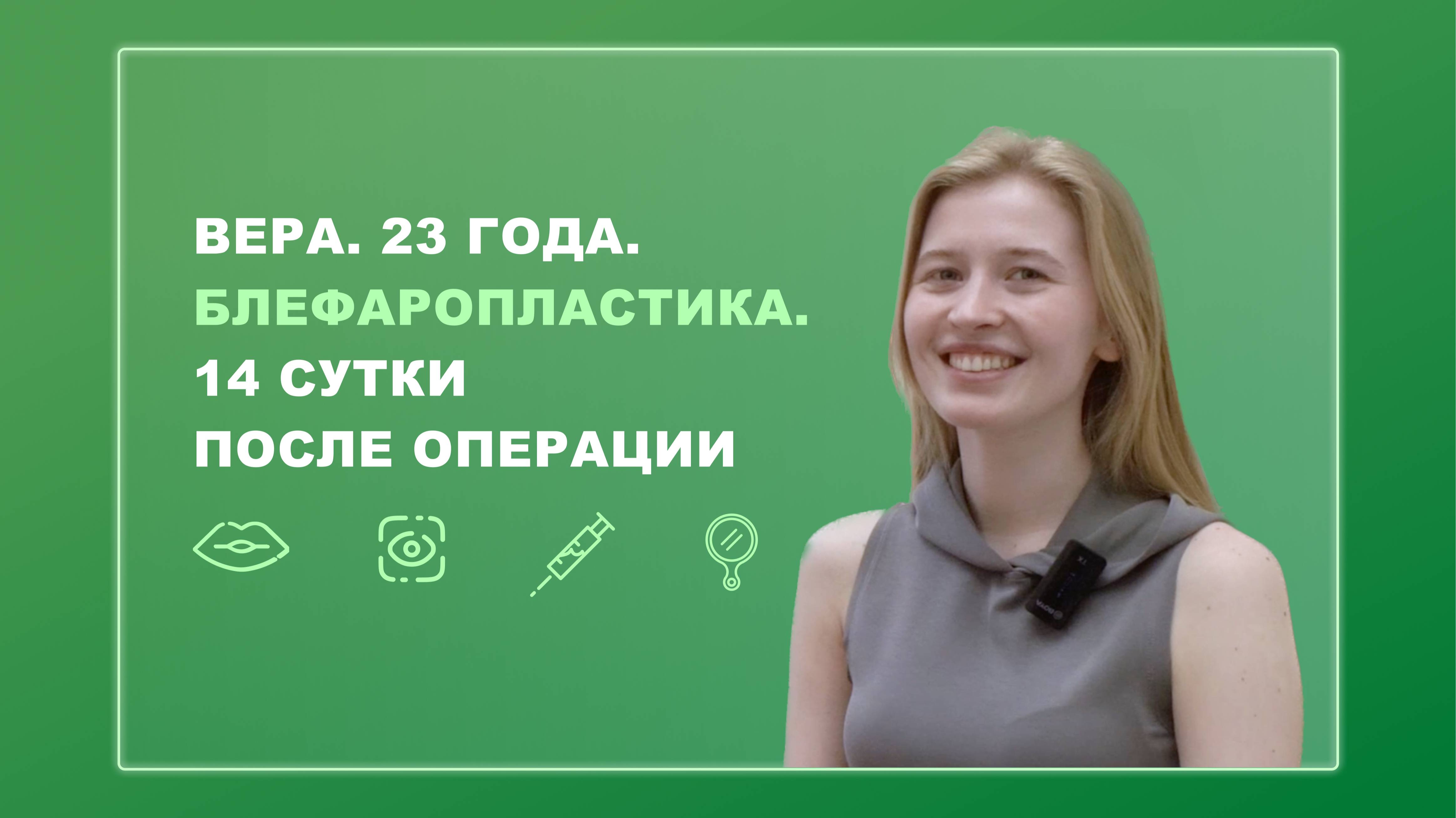 Вера. 23 года. Блефаропластика. 14 сутки после операции