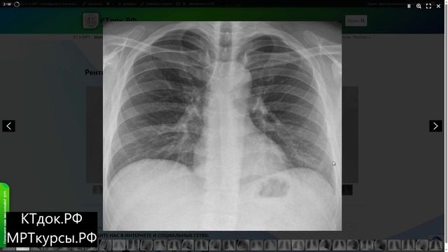 Рентген с репетитором. Erid: 2VtzqwJkvfy