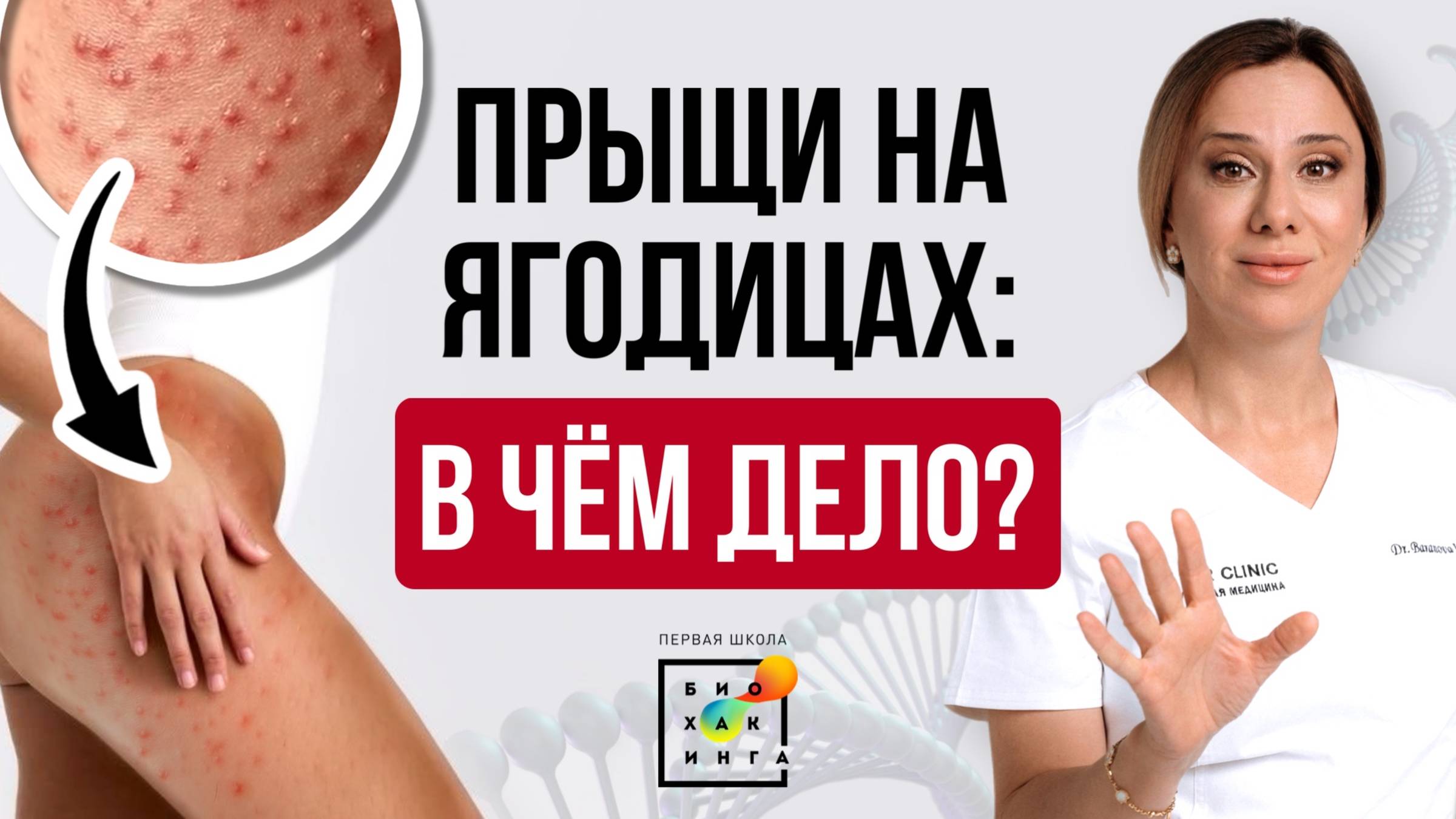 Как победить грибок ногтей? Интимное омоложение лазером: за или против? Ответы на вопросы #пшб