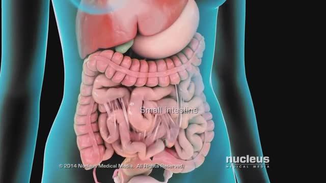 Спаечная болезнь брюшины и лапароскопический адгезиолизис