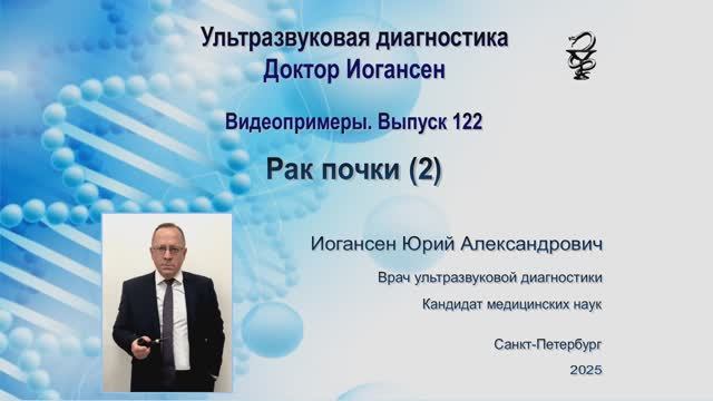 УЗИ. Доктор Иогансен. Видеопримеры. Выпуск 122. Рак почки (2).