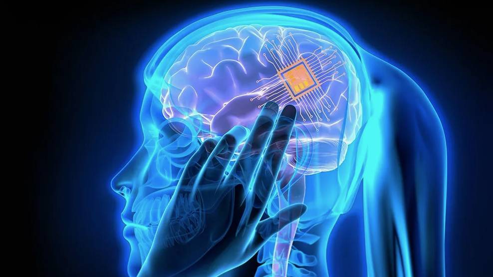 Илон Маск заимствовал имплантанты у инопланетян.