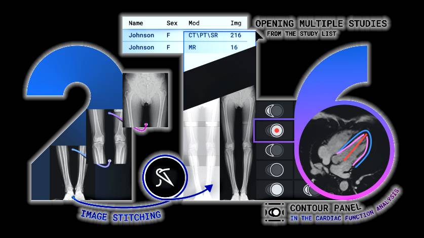 Новые функции в Inobitec DICOM Viewer 2.16