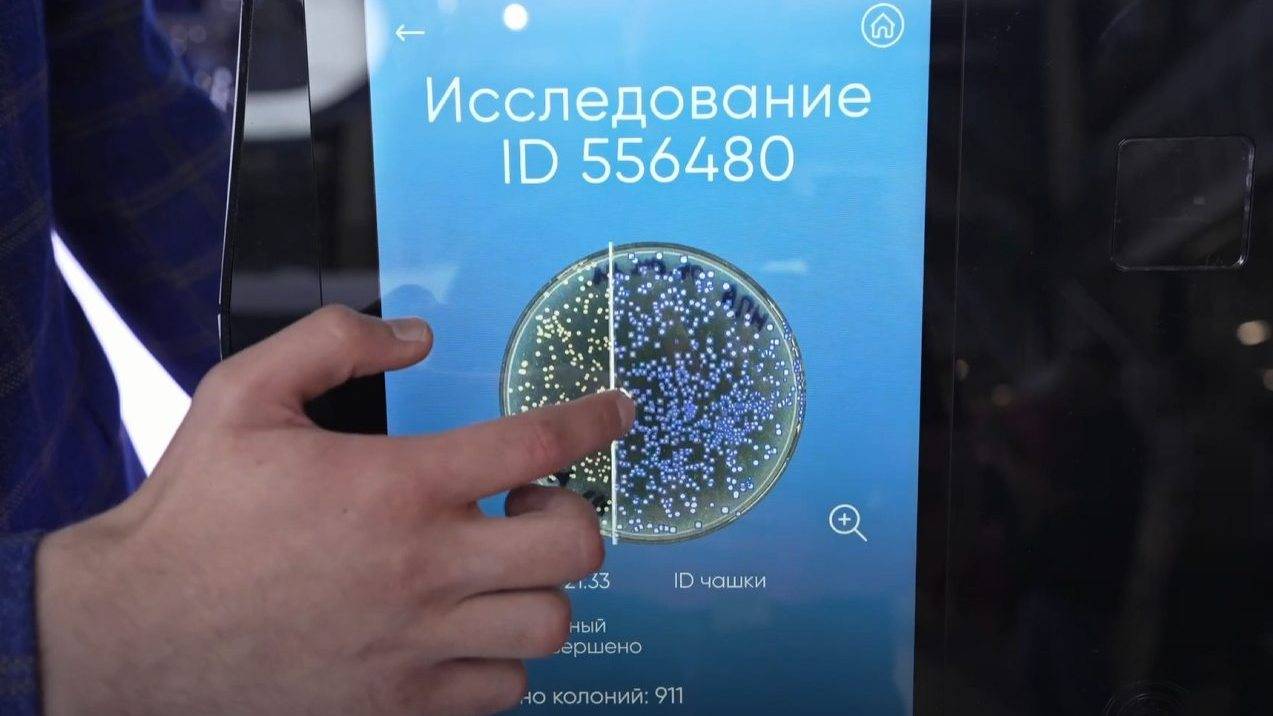 Нейрочип поможет контролировать рост микроорганизмов