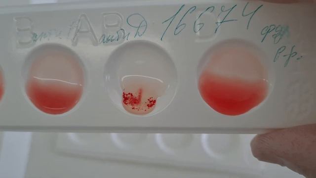 017. Определение группы крови и RhD моноклонами. Grifols. DAT+. 17.03.2022 г.