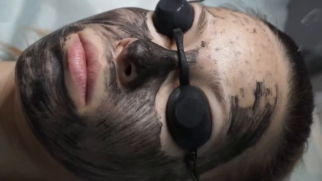 Карбоновый Пилинг Лица