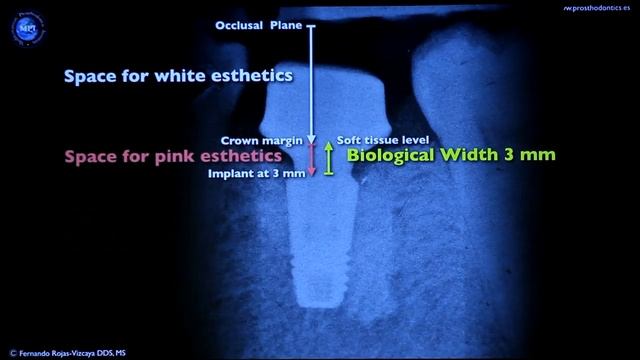 Стоматология. Курс Фернандо Рохас-Вискайя.