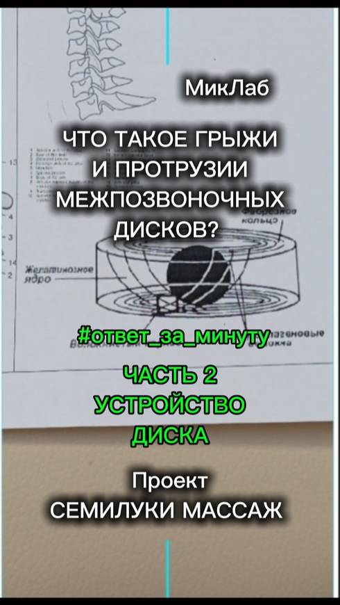 Что такое ГРЫЖА и ПРОТРУЗИЯ межпозвоночных дисков? Часть 2. Устройство диска. Ответ за минуту
