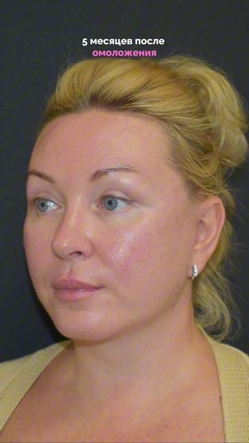 😍 Как стать моложе на 10 лет и при этом остаться собой