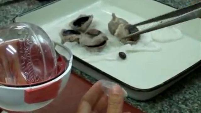 006 Анатомия глаза