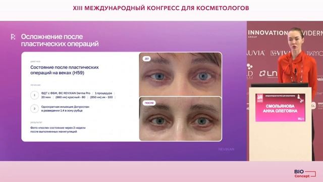 Смольянова Анна. Фотодинамическая терапия в лечении осложнений