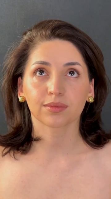 ДО/ПОСЛЕ блефаропластика