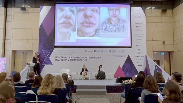 ФДТ REVIXAN в коррекции осложнений инъекционной и аппаратной косметологии. Смольянова А.О.